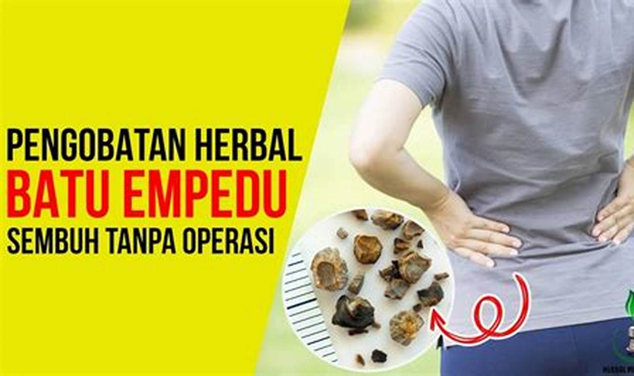 Cara Mengatasi Batu Empedu | investigasi.id