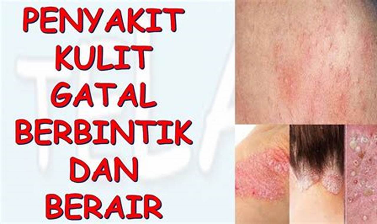 Cara Mengatasi Gatal Gatal Pada Kulit | investigasi.id