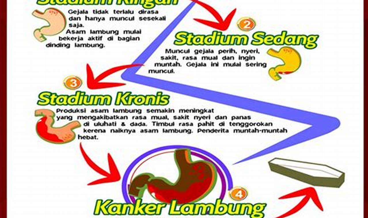 Cara Mengatasi Lambung Perih | investigasi.id