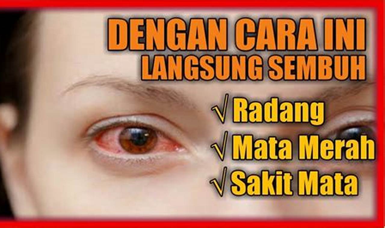 Cara Mengatasi Mata Merah Sebelah | investigasi.id